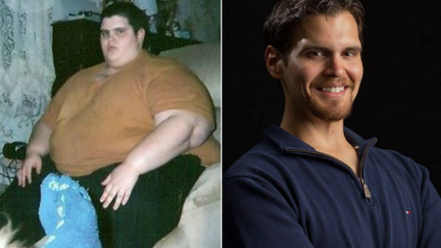 Jovem que Já Pesou 360 kg Larga o Vício em Comida e Hoje Pesa 100 kg ...