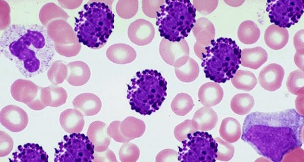 Basófilos Altos ou Baixos Demais - O Que Significa - MundoBoaForma.com.br