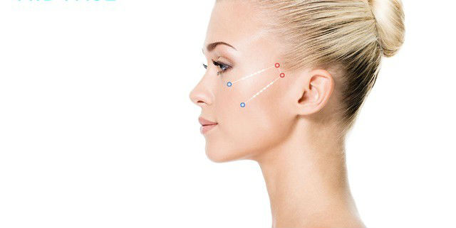 Fio Russo - O Que é, Como Funciona, Antes e Depois, Cuidados e Dicas ...