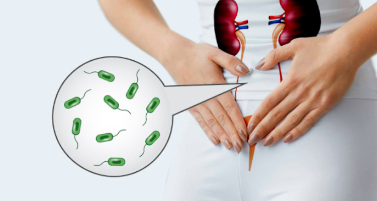 O Que é Infecção Urinária? Cuidados e Dicas - MundoBoaForma