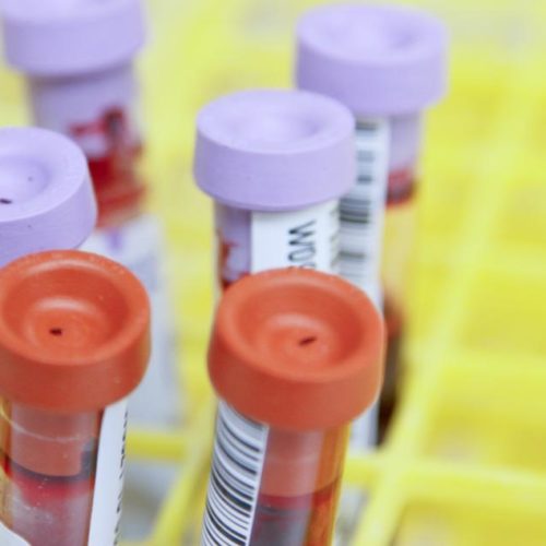 Tudo sobre suplemento alimentar - MundoBoaForma