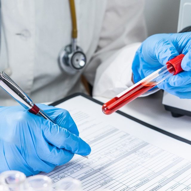 Tudo sobre exames de sangue - MundoBoaForma