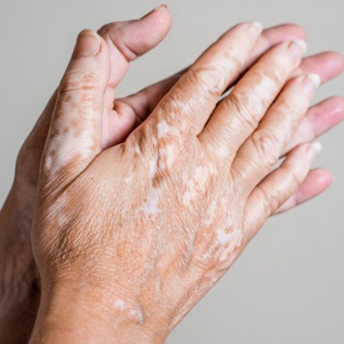 Estética - MundoBoaForma