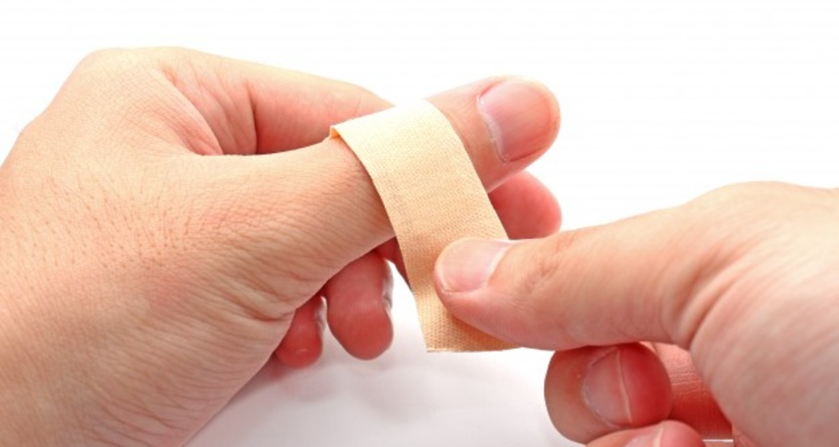 Como curar uma ferida mais rápido - MundoBoaForma