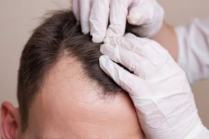 Ferida Na Cabeça Causas E Como Tratar Mundoboaforma