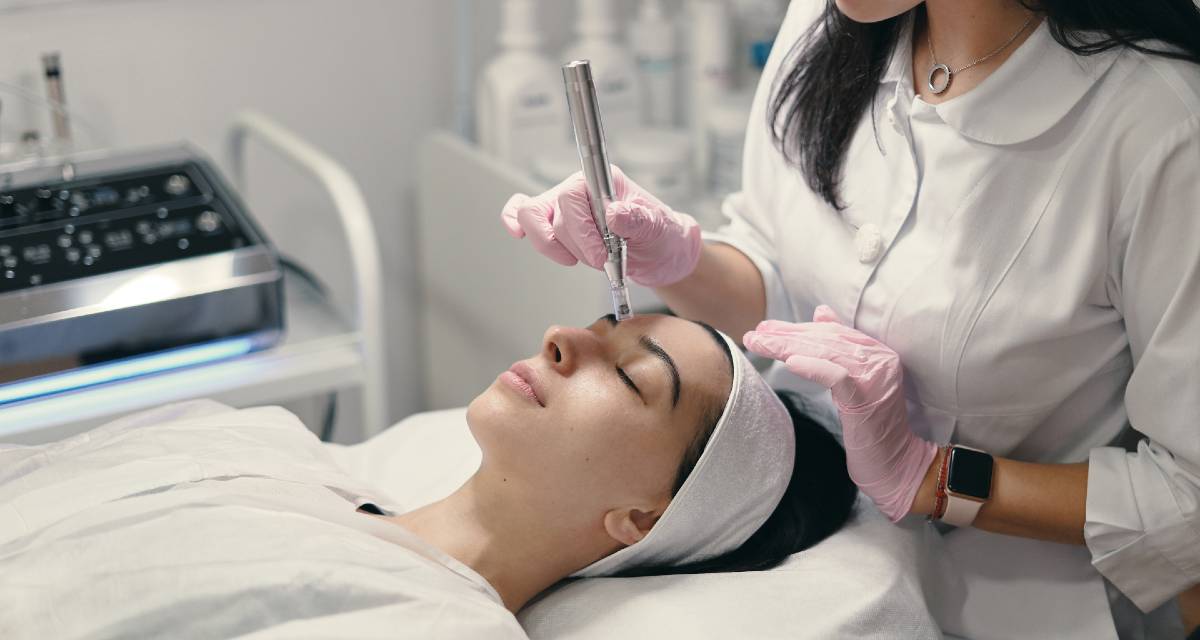 Microagulhamento: o que é, para que serve e como fazer - MundoBoaForma