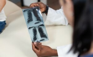 8 tipos de infecções pulmonares e seus sintomas - MundoBoaForma