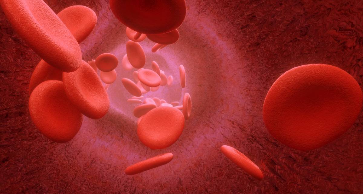 Anemia falciforme: o que é, causa, sintomas e tratamentos - MundoBoaForma