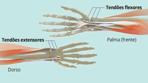 Tendinite no pulso: principais causas, sintomas e tratamentos - MundoBoaForma