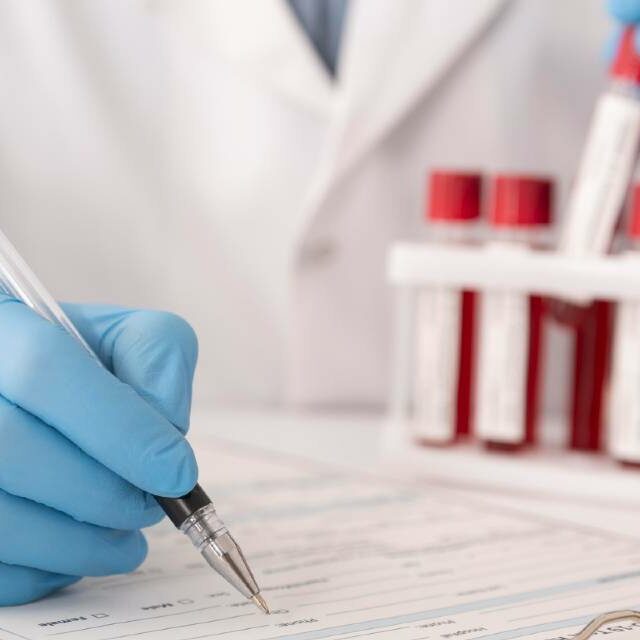 Para que serve o exame VHS e valores de referência - MundoBoaForma