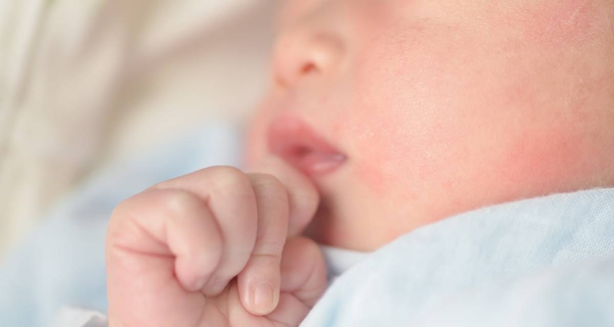 Milium na pele: o que é, sintomas e como tirar - MundoBoaForma