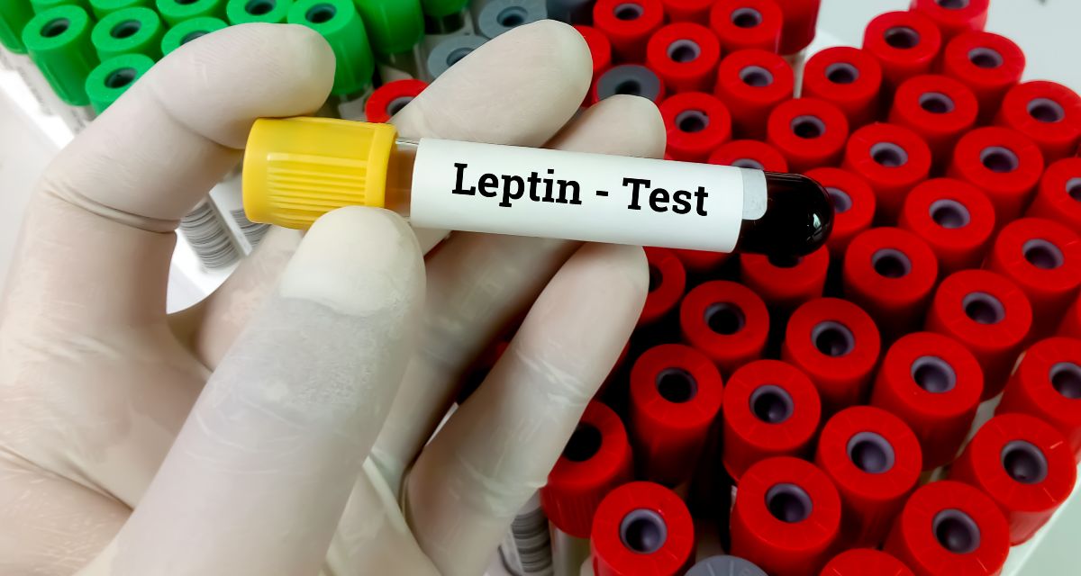 Leptina alta ou baixa: o que preciso saber? - MundoBoaForma