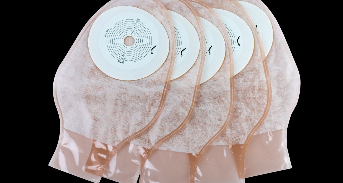 Ileostomia: o que é, para que serve e cuidados? - MundoBoaForma