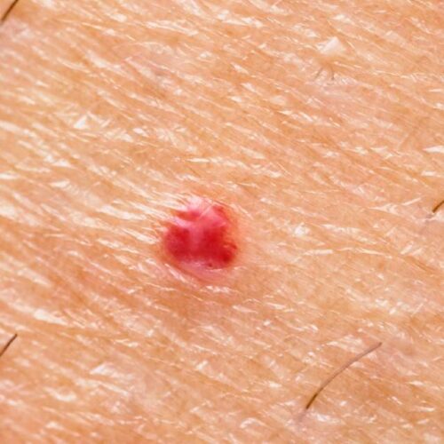 Estética - MundoBoaForma