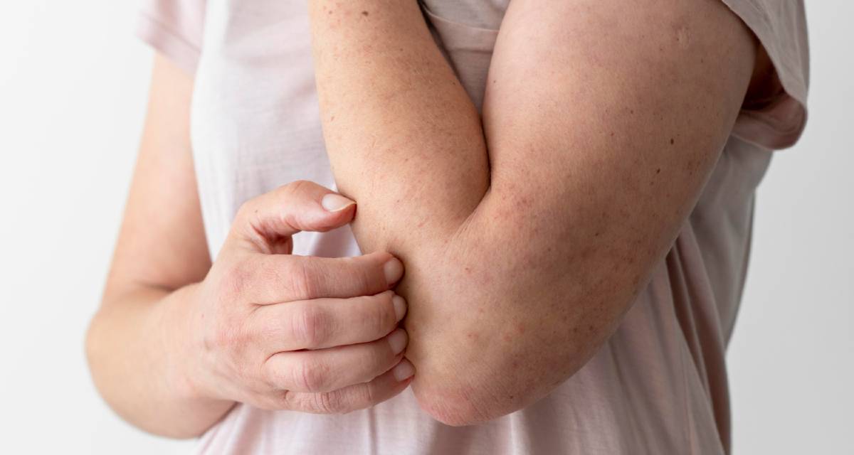 Colestase: o que é, sintomas, causas e tratamento - MundoBoaForma