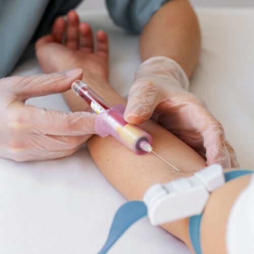 O Que Mostra um Exame de Sangue Completo - MundoBoaForma