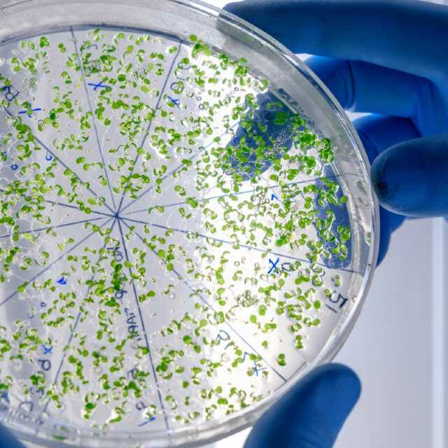 Epidemia mortal de infecção por fungo no cérebro assola a África ... Epidemia mortal de infecção por fungo no cérebro assola a África ...
