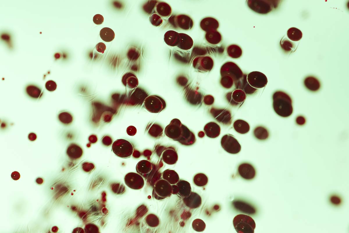 Microcitose: o que é, principais causas e tratamentos - MundoBoaForma