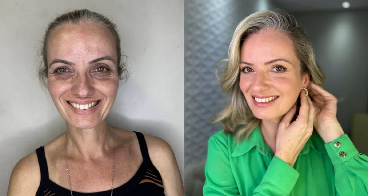 Peeling de fenol viraliza na web mas médicos fazem alertas sobre o ...