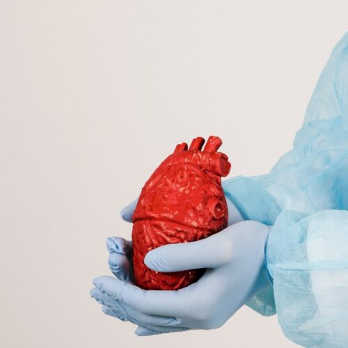 Coração grande (cardiomegalia): causas, sintomas e tratamentos ...