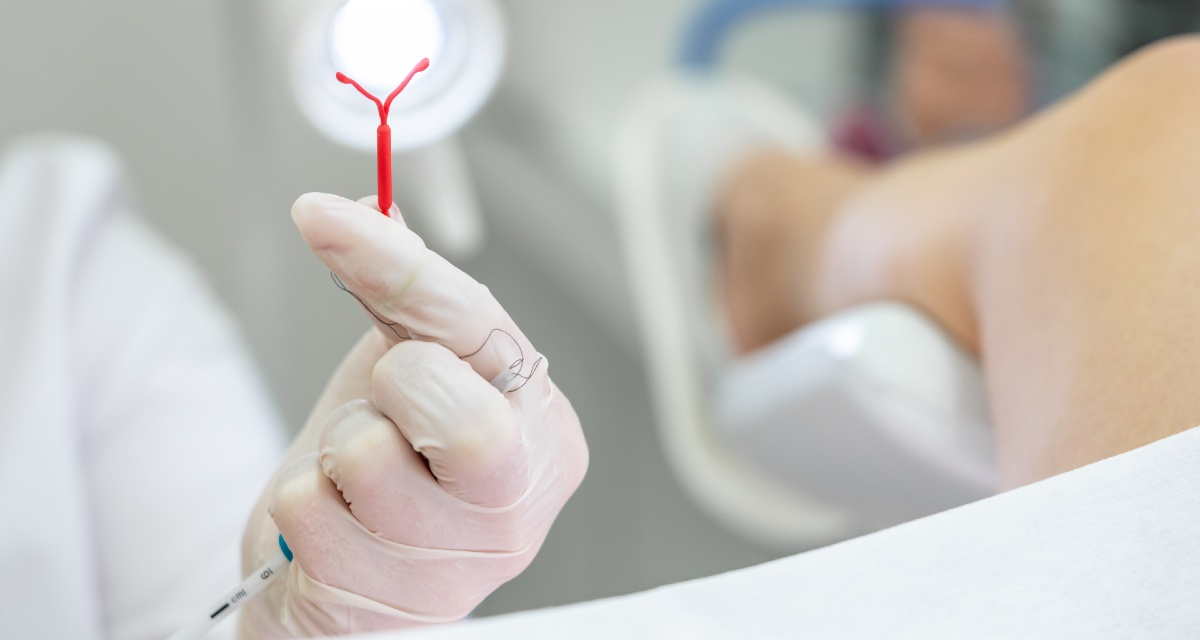 "Nasceu segurando o DIU": quais as chances de engravidar usando esse ...