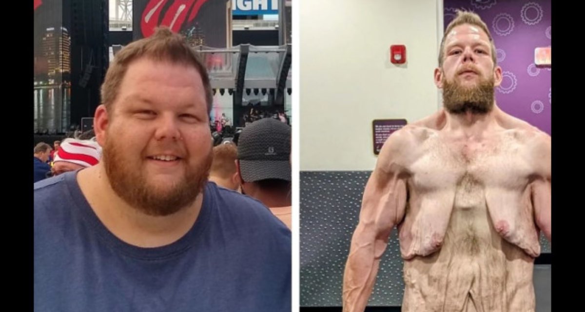 Cole Prochaska perdeu 150 kg e compartilhou as imagens impressionantes ...