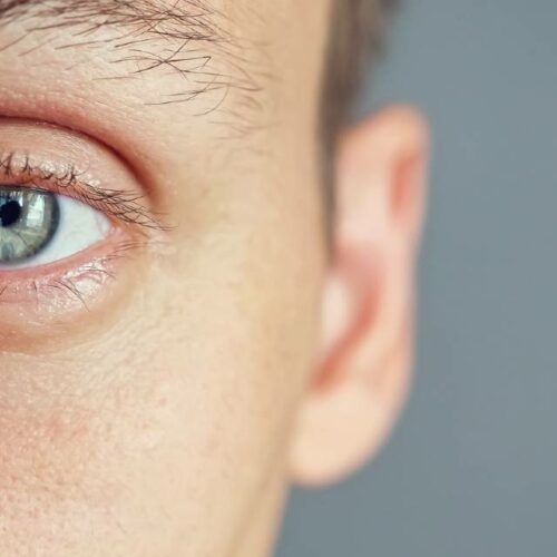 Tudo sobre problemas nos olhos e vista - MundoBoaForma