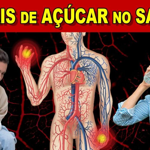 9 sintomas do colesterol alto! Sinais que você não pode ignorar [VÍDEO EXCLUSIVO] - MundoBoaForma