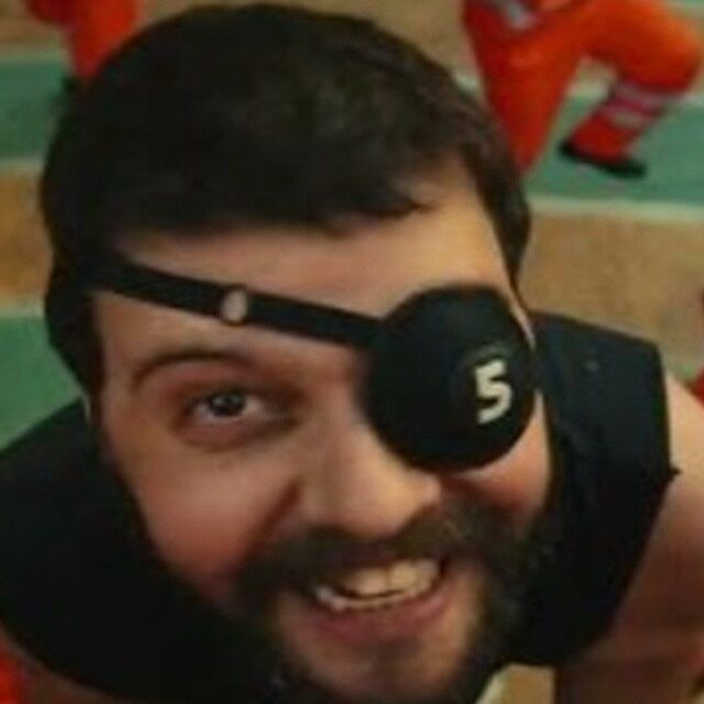 Olho caído: Diogo Defante fez cirurgia para corrigir ptose palpebral, o ...