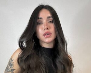 Maria Venture admite arrependimento com procedimento estético no rosto ...