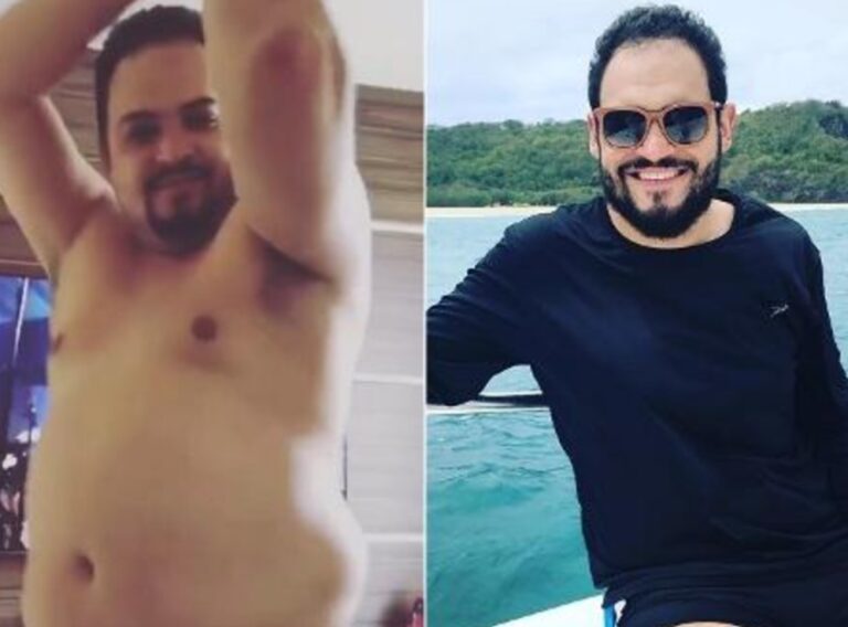 Humorista Matheus Ceará se arrepende de ter feito cirurgia bariátrica ...