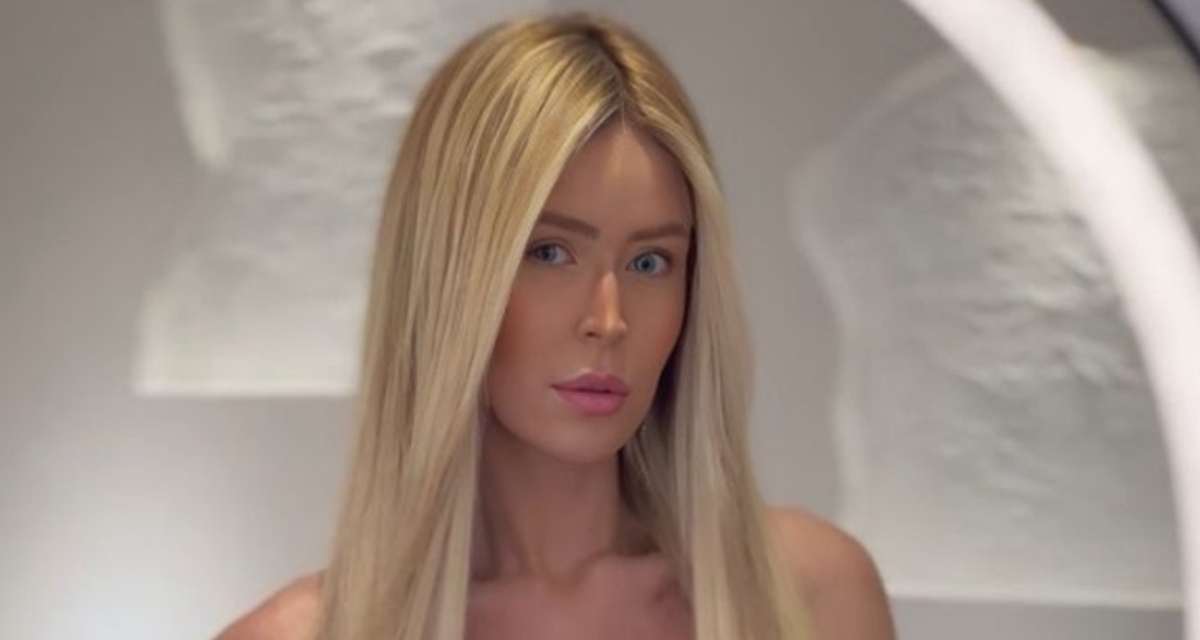 Noiva de Latino conta como recuperou saúde capilar após sofrer corte ...