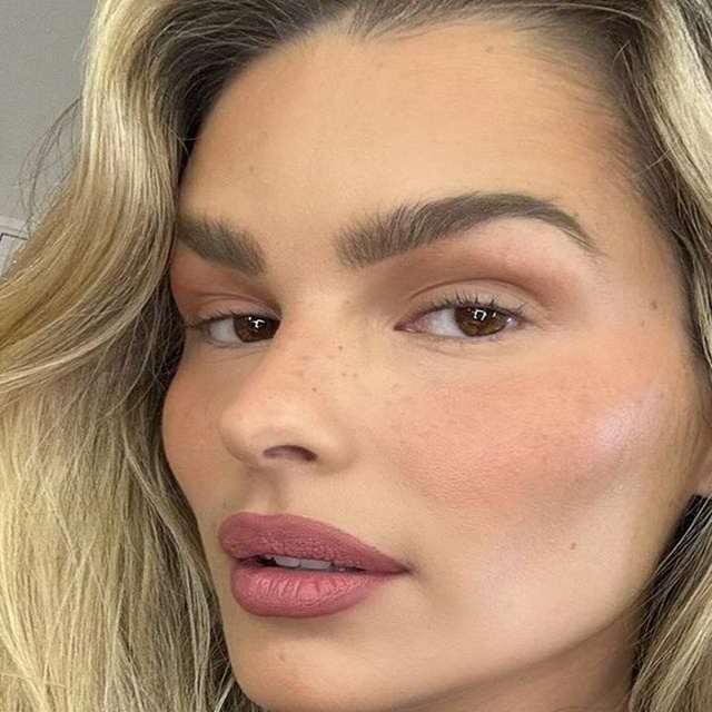 Yasmin Brunet mostra o corpo após tratamento para lipedema e rebate ...