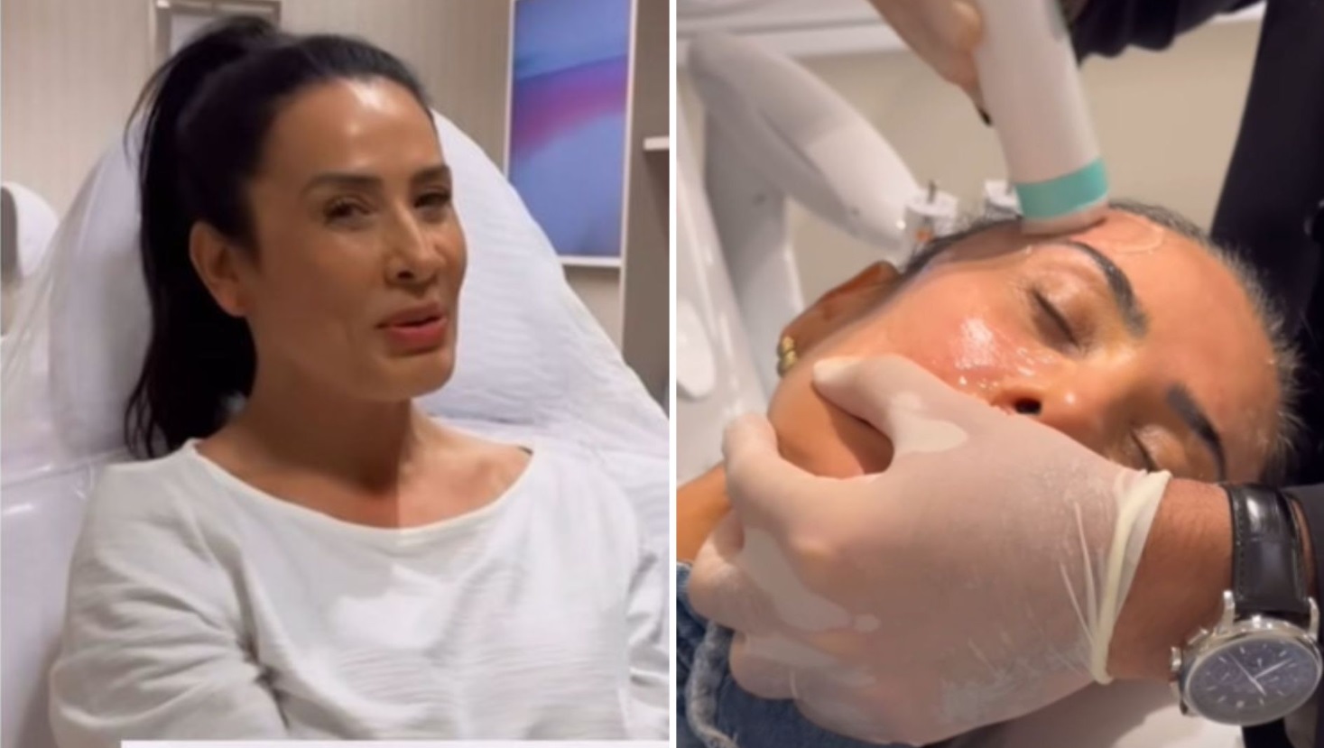 Scheila Carvalho remove ácido hialurônico do rosto: "Meu olhar abriu" - MundoBoaForma