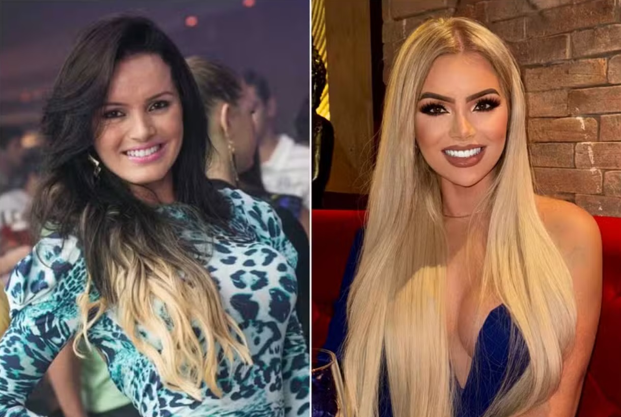 Thalita Zampirolli surge irreconhecível e conta quanto já gastou em procedimentos - MundoBoaForma