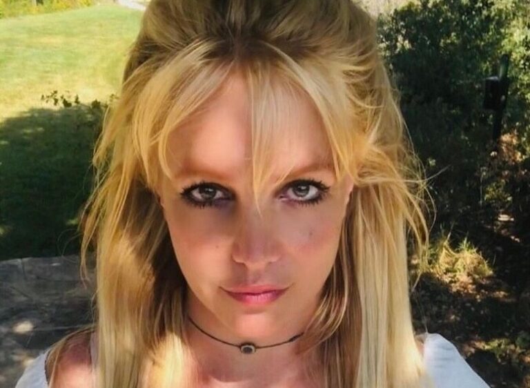 Britney Spears faz alerta após acidente em casa: "Meu rosto pegou fogo ...