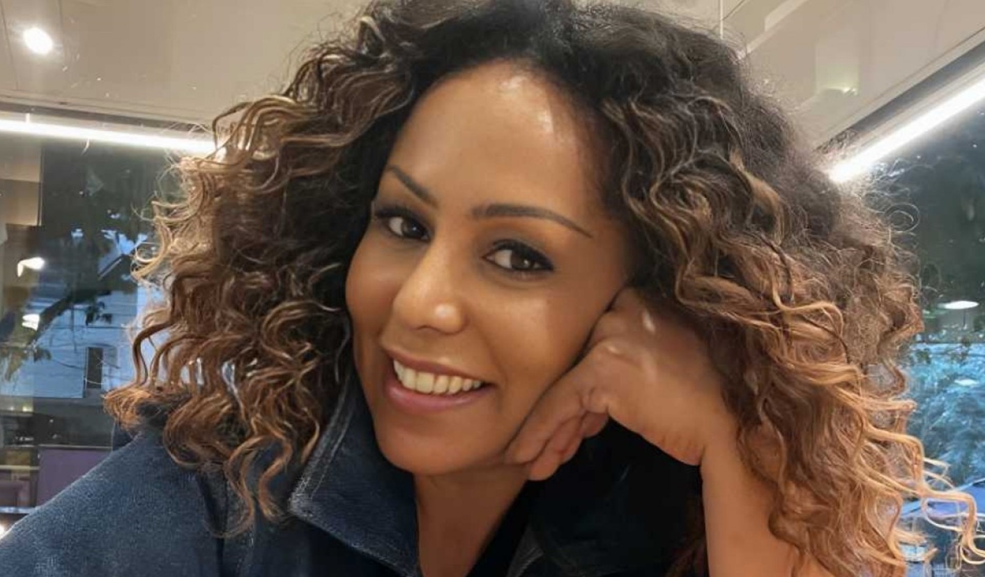 Valeria Valenssa comenta a alopecia de tração, condição que afeta ...