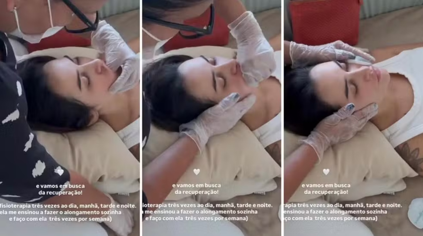 Gabi Melim faz terapia três vezes ao dia após diagnóstico de paralisia ...