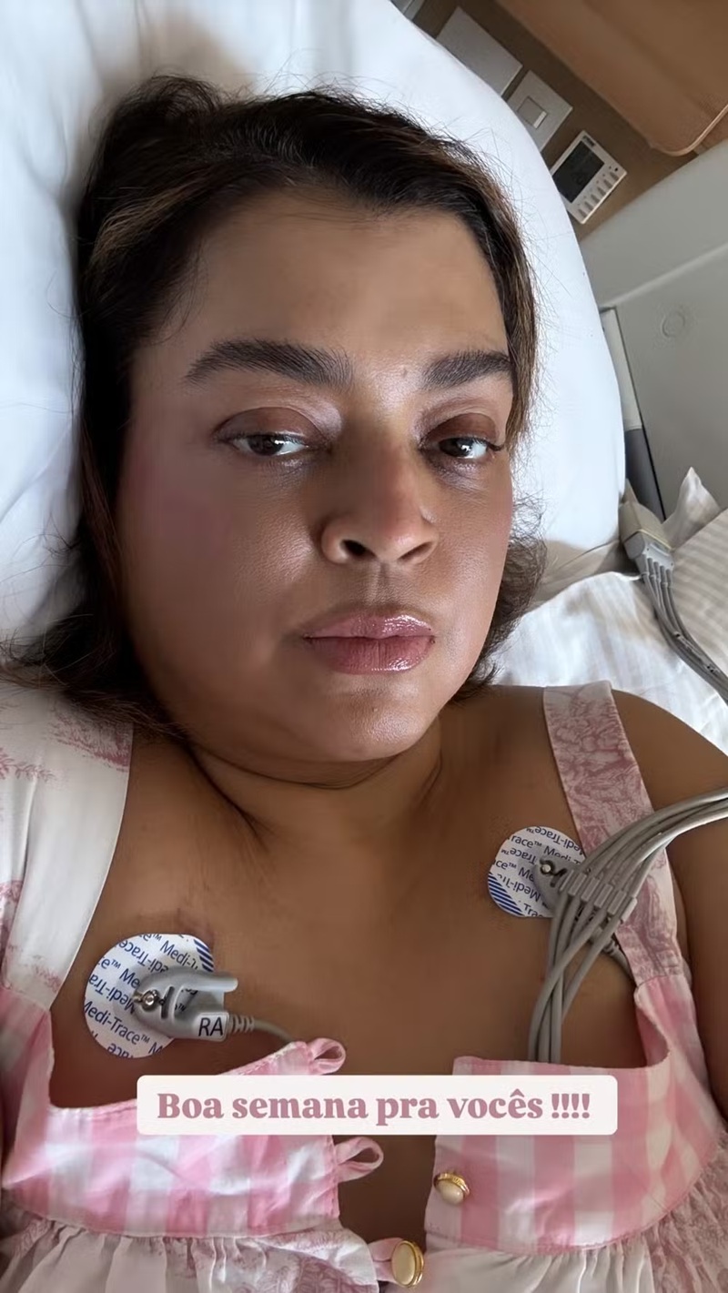 Após nova cirurgia, Preta Gil coloca bolsa de colostomia definitiva: "Não tinha ideia que fosse ...